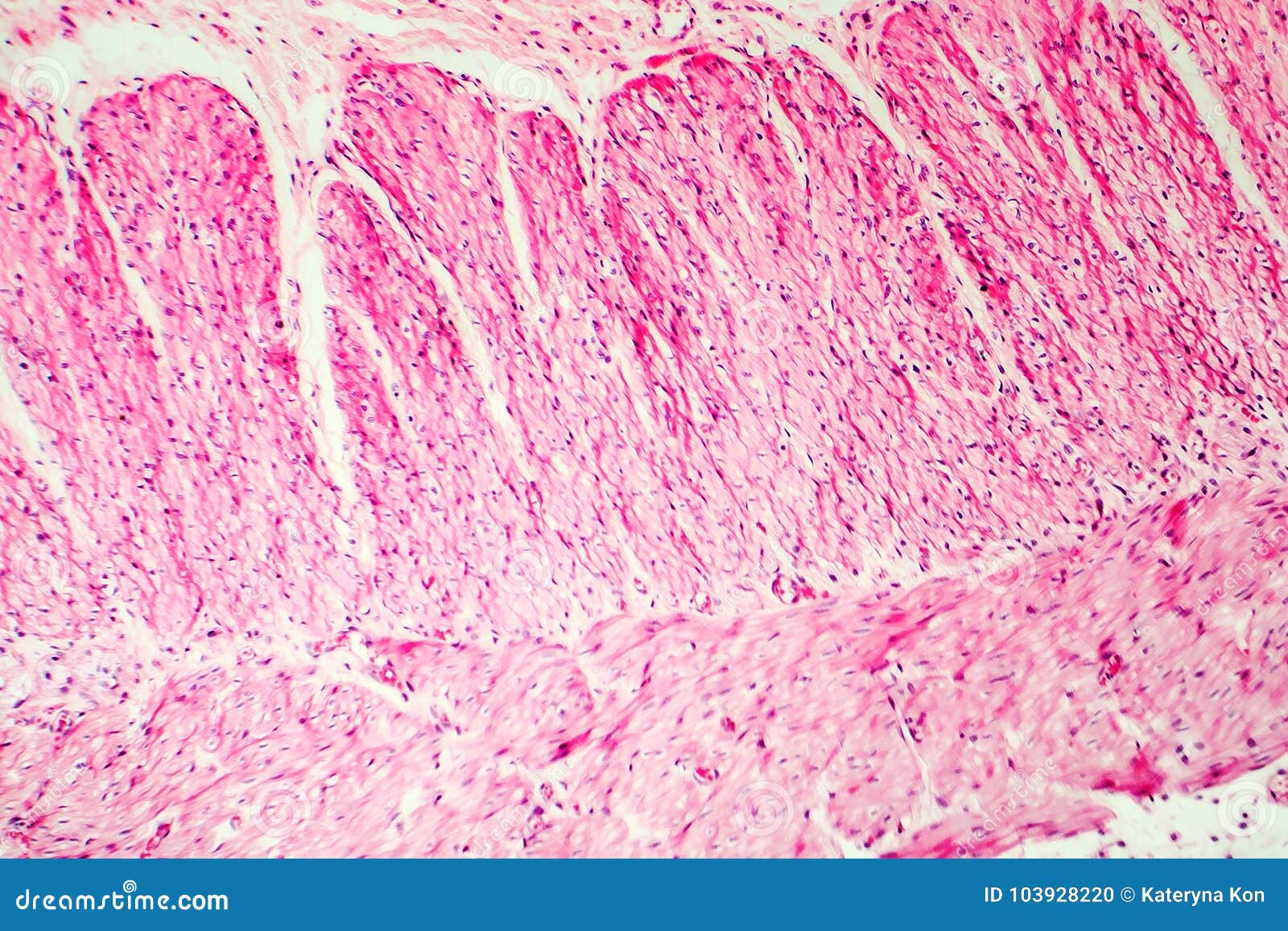 Human smooth muscle stock photo. Image of photomicrograph - 103928220