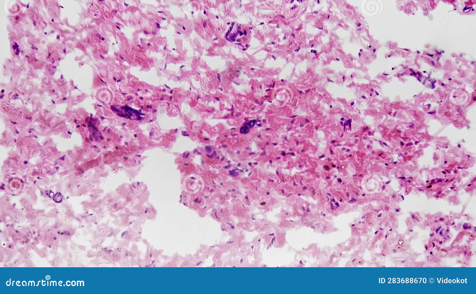 Human Smooth Muscle in Longitudinal Section Filmed Under Microscope ...