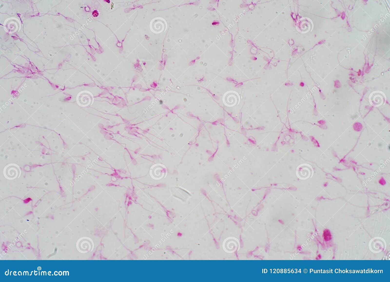 Human Sperm Morphology Under Microscope. Stock Photo - Image of ...