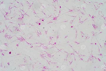 Human Sperm Morphology Under Microscope. Stock Photo - Image of body ...