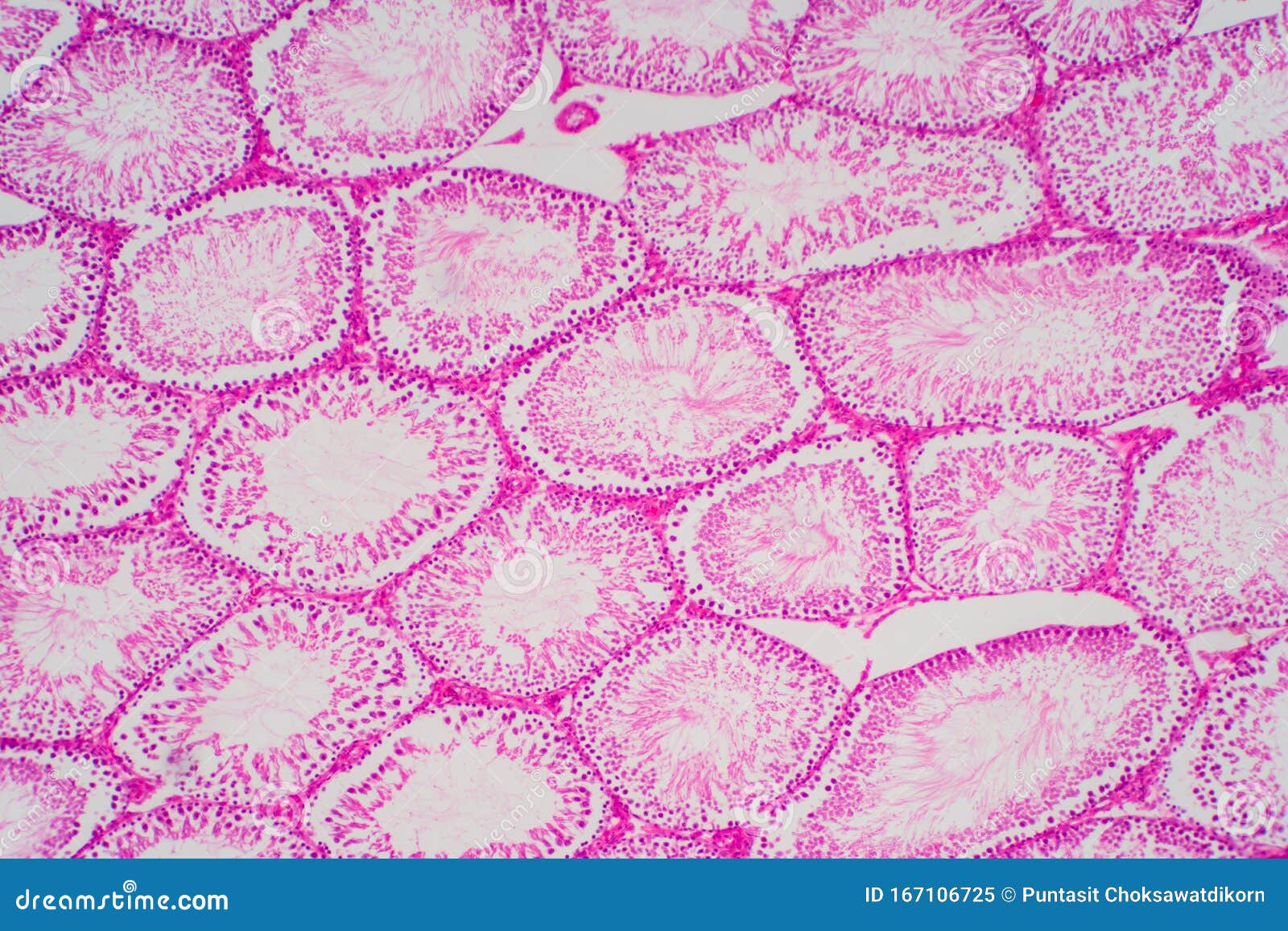 Human Sperm In The Testis Morphology Under Microscope Stock Photography ...