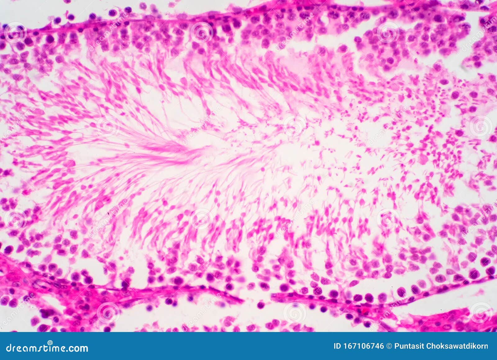 Human Sperm Cell Under Microscope