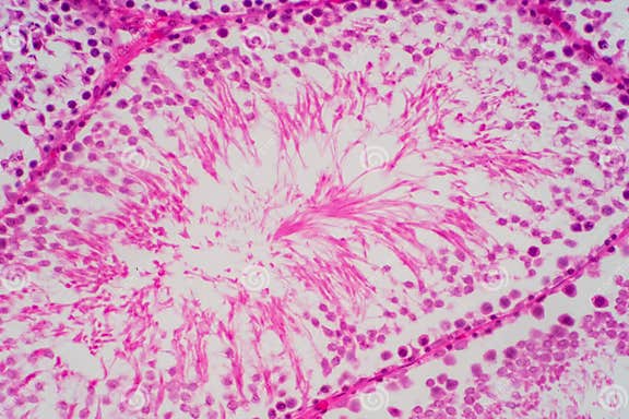 Human Sperm in the Testis Morphology Under Microscope Stock Image ...