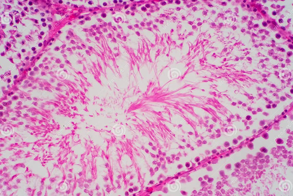 Human Sperm in the Testis Morphology Under Microscope Stock Image ...