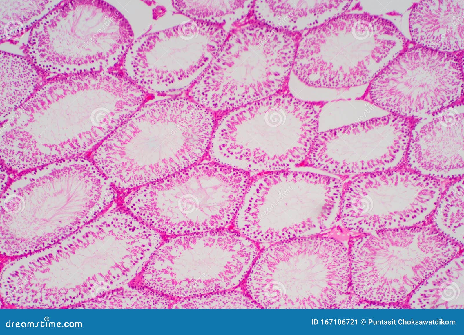 Human Sperm in the Testis Morphology Under Microscope Stock Image ... Human Sperm in the Testis Morphology Under Microscope Stock Image ...
