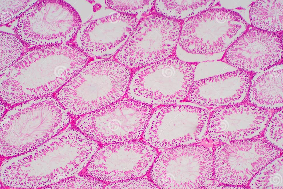Human Sperm in the Testis Morphology Under Microscope Stock Image ...