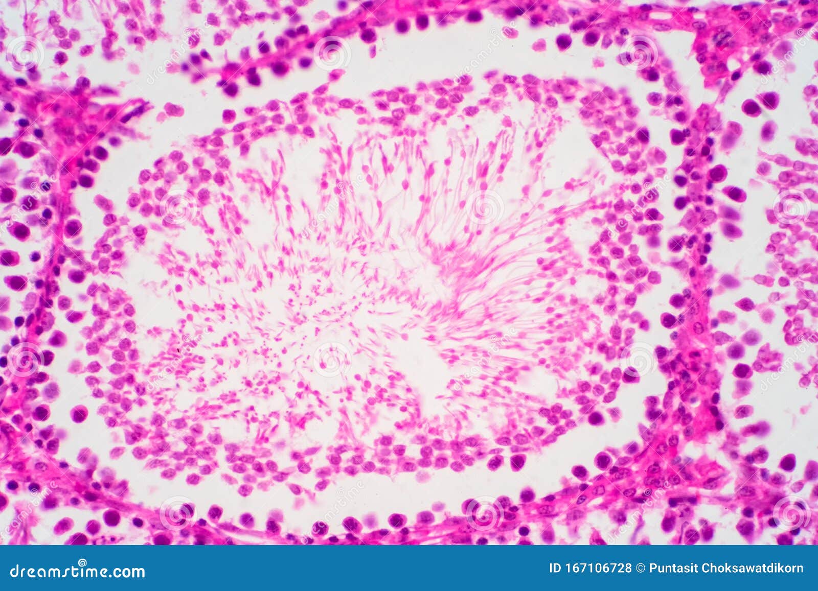 Human Sperm in the Testis Morphology Under Microscope Stock Photo ...