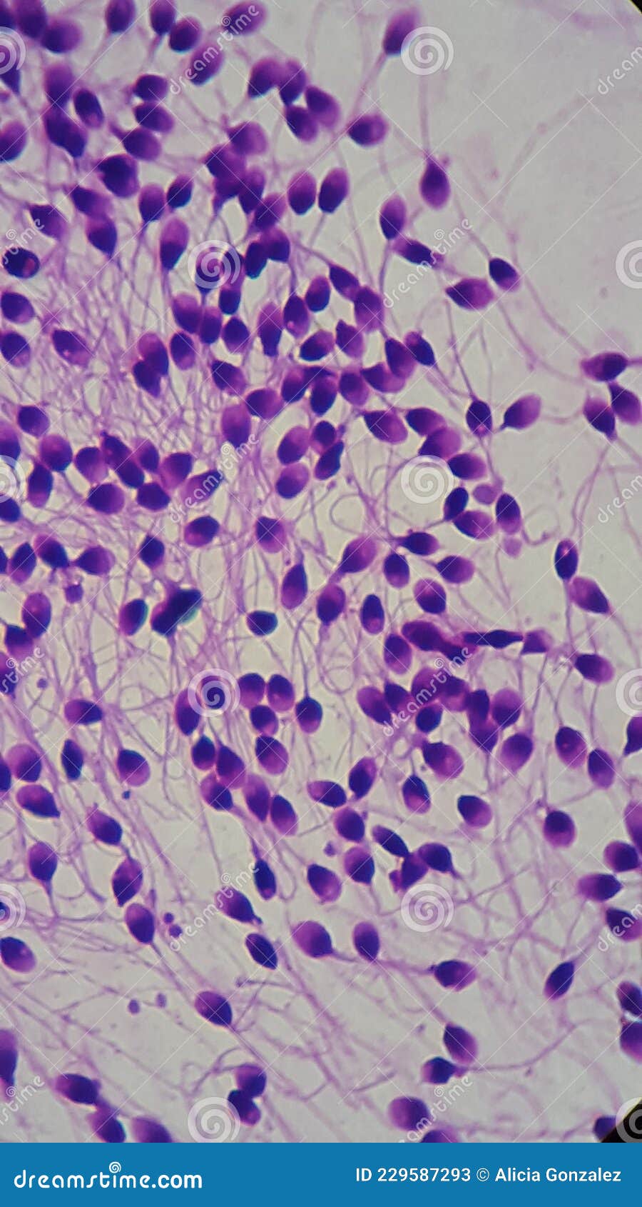 Spermatozoo Umano Al Microscopio La Scoperta Del Complesso Proteico