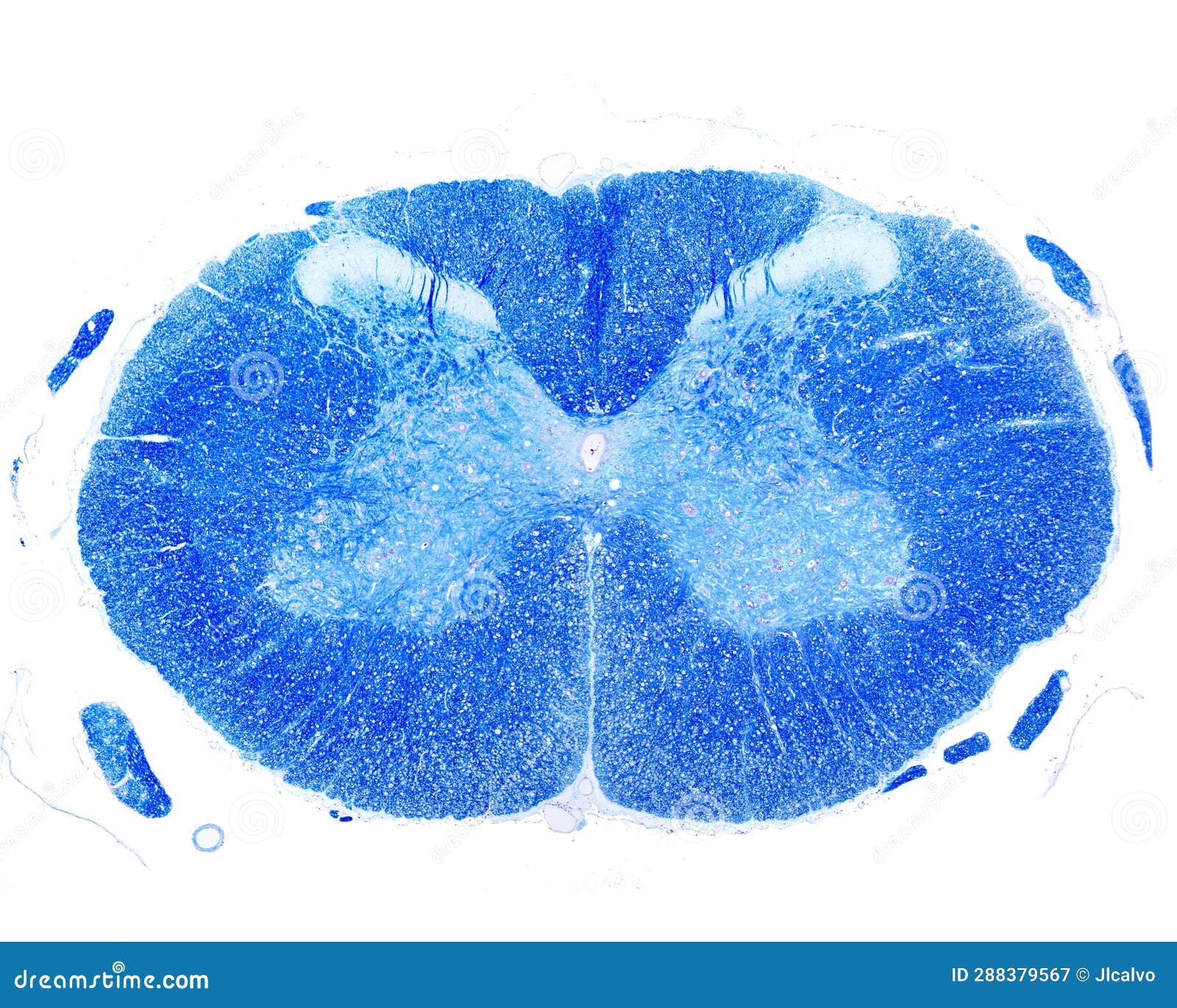Human Spinal Cord. Luxol Fast Blue Stain Stock Image - Image of grey ...