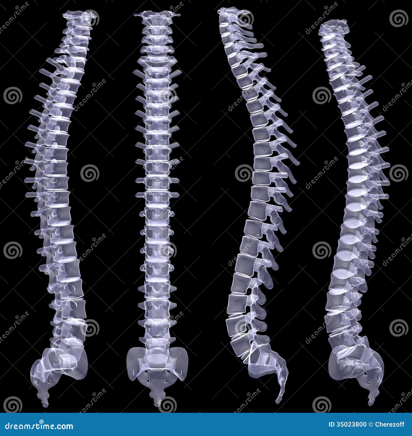 Human spine stock illustration. Illustration of healthcare - 35023800