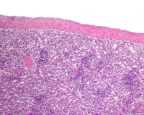 Small Intestine. Paneth Cells Stock Photo - Image of gastrointestinal ...