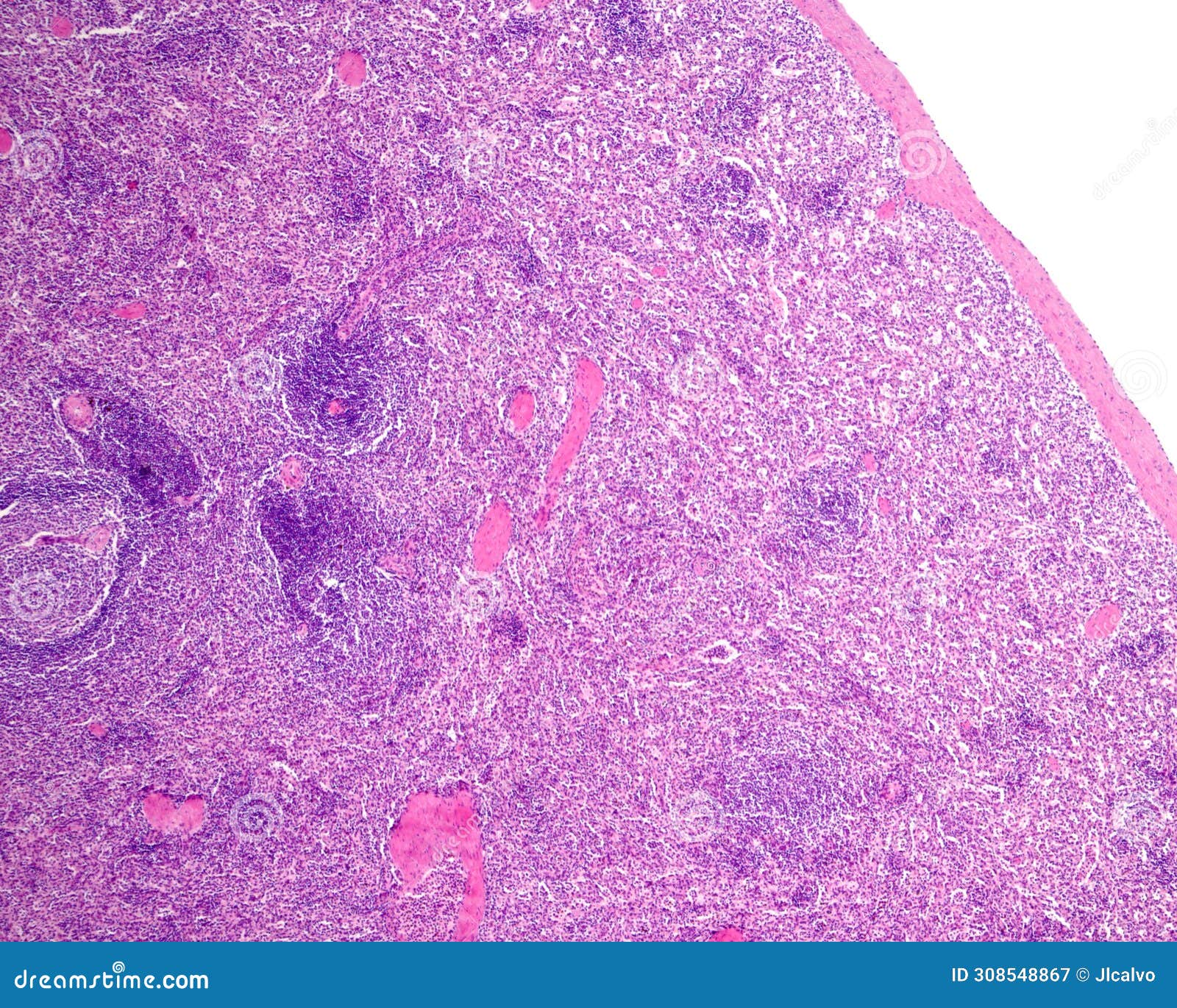 Human spleen stock image. Image of histological, white - 308548867