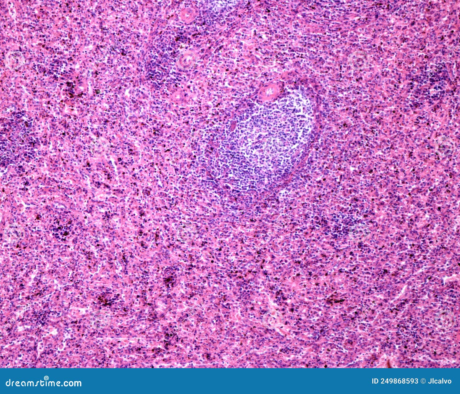 Human Spleen. Lymphoid Follicle Stock Image - Image of pulp ...