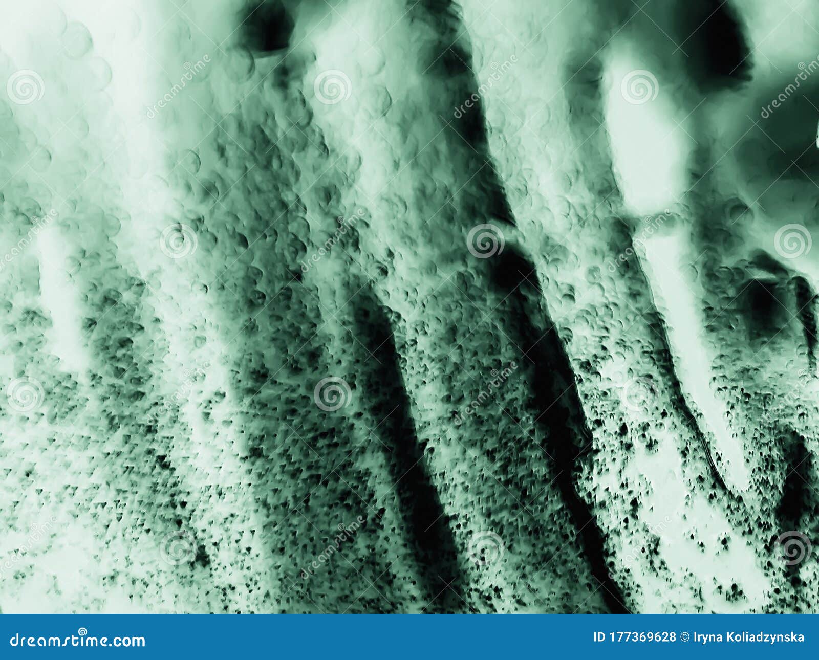 Human Squamous Cell Carcinoma. Tissues Affected by Cancer Cells Under a ...