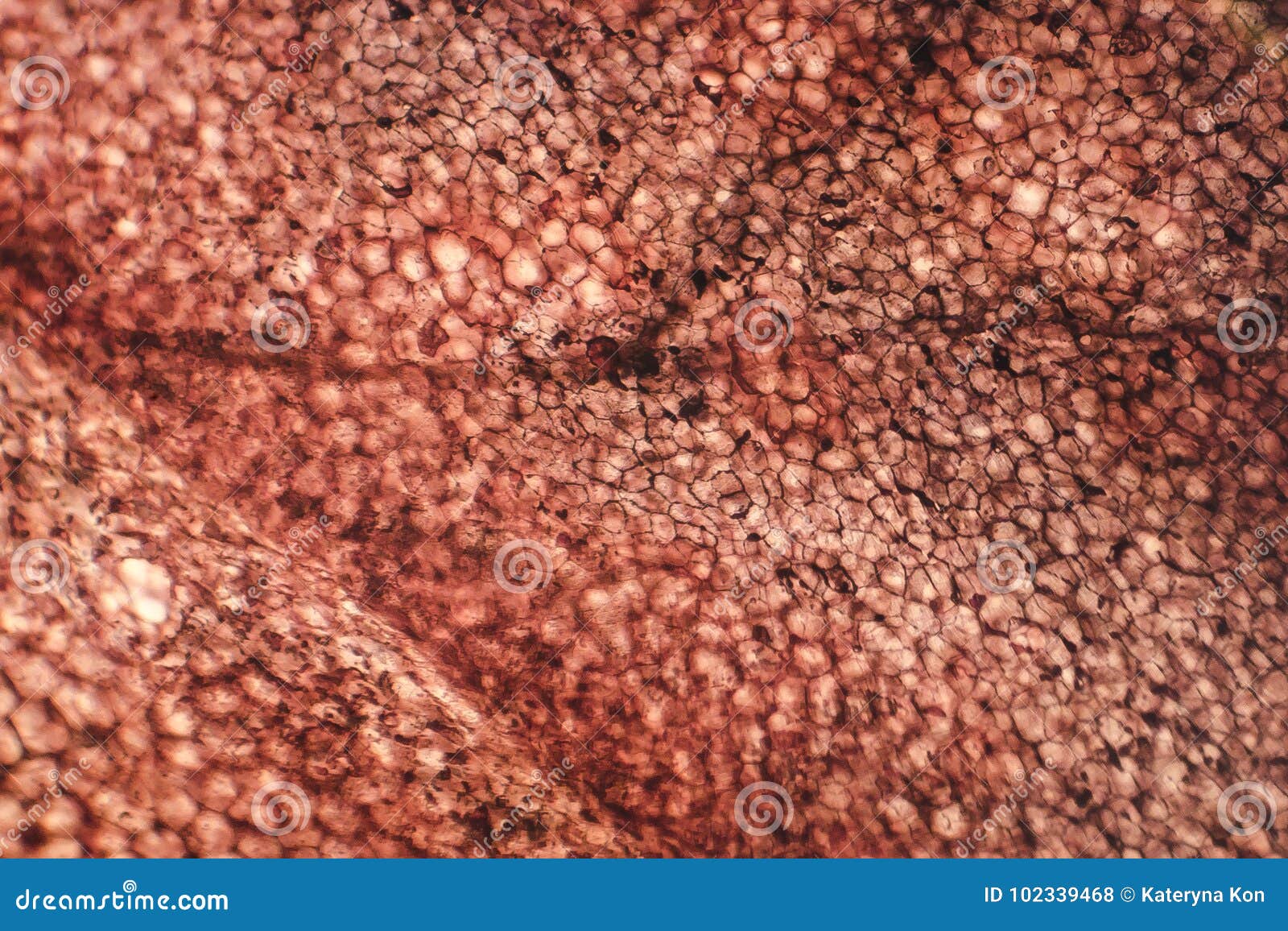Human Squamous Epithelium Under the Microscope Stock Photo - Image of ...