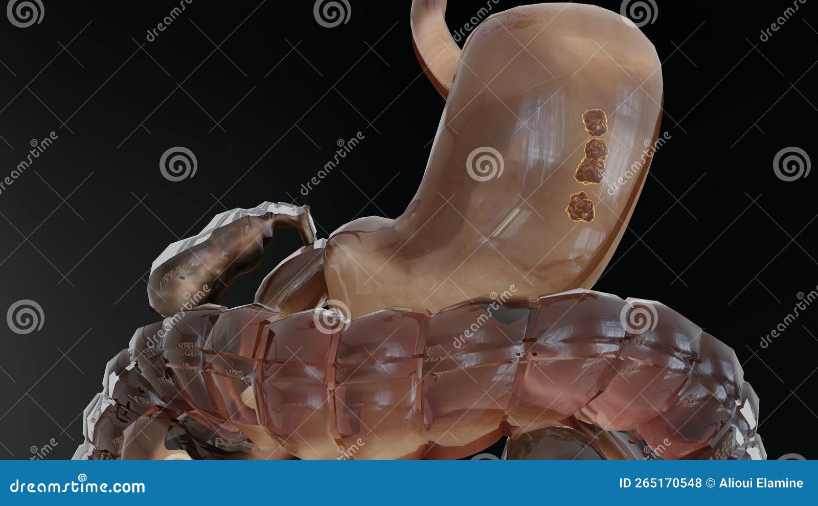 Intestine With Constipation Internal Organs Digestive System. Abdominal ... Intestine With Constipation Internal Organs Digestive System. Abdominal ...