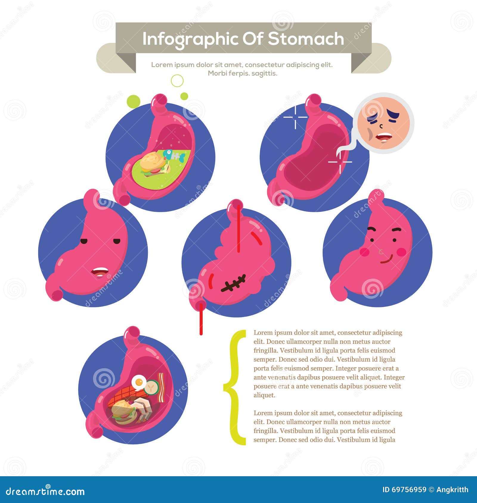 Stomach Infographic Infocharts Vector Illustration | CartoonDealer.com ...