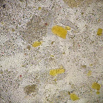 Human Stool Sample Under Microscope Stock Image - Image of nature ...