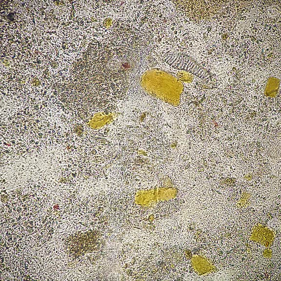 Human Stool Sample Under Microscope Stock Image - Image of nature ...