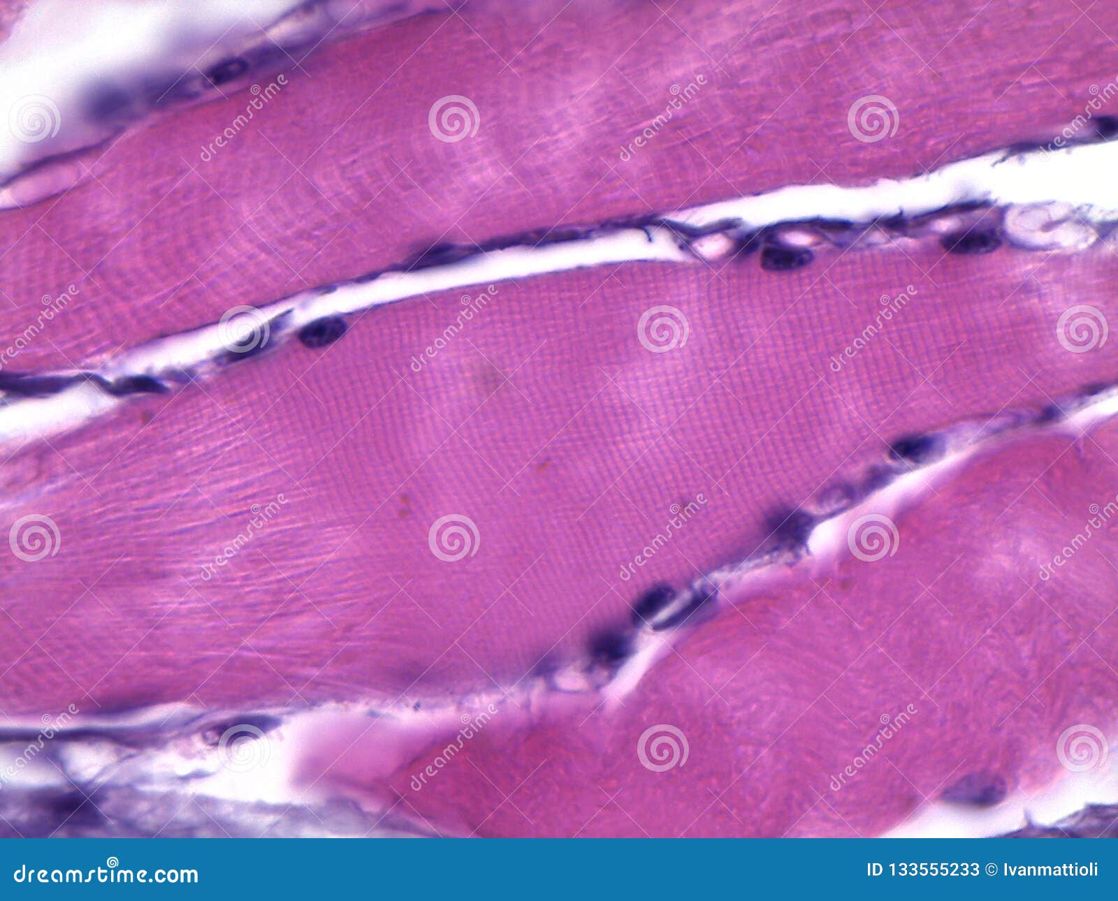 Striated Muscle Tissue Under The Microscope Stock Photography ...