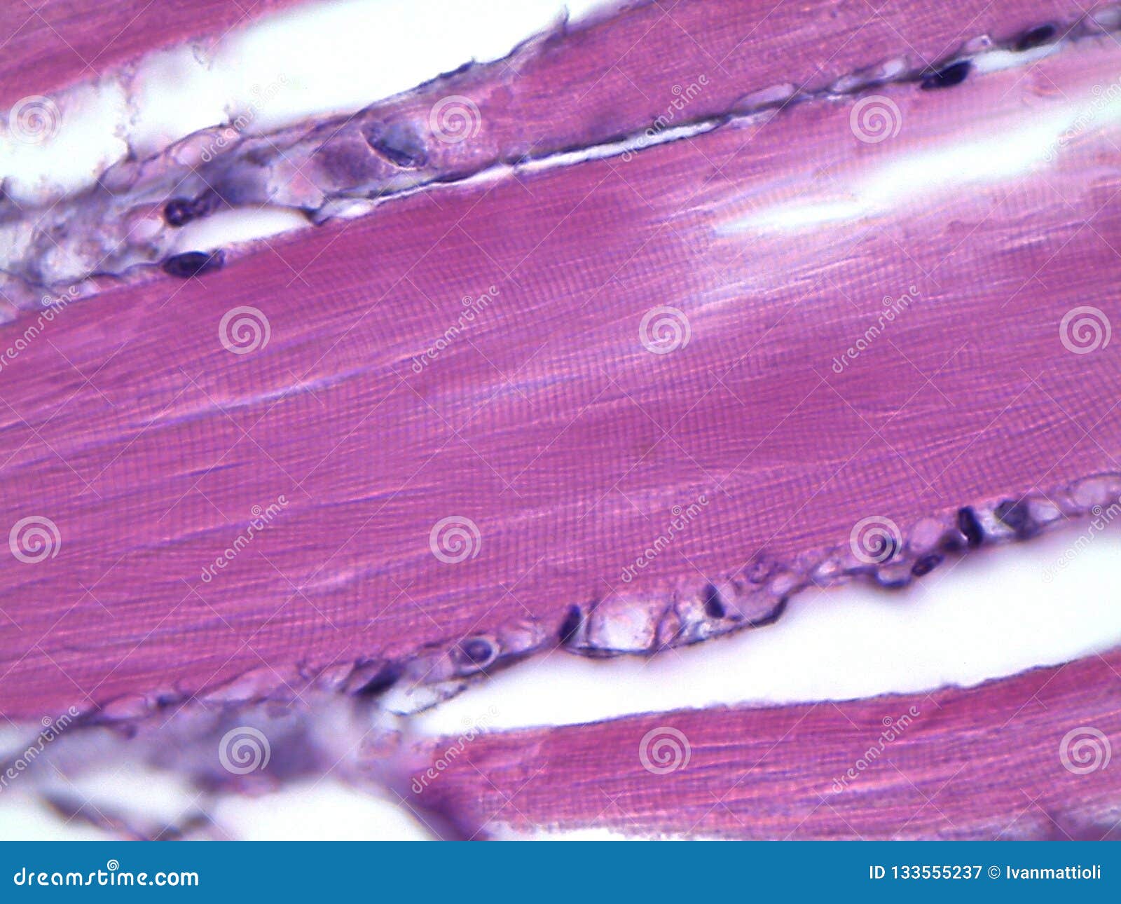 Striated Muscle Tissue Under The Microscope Stock Photography ...