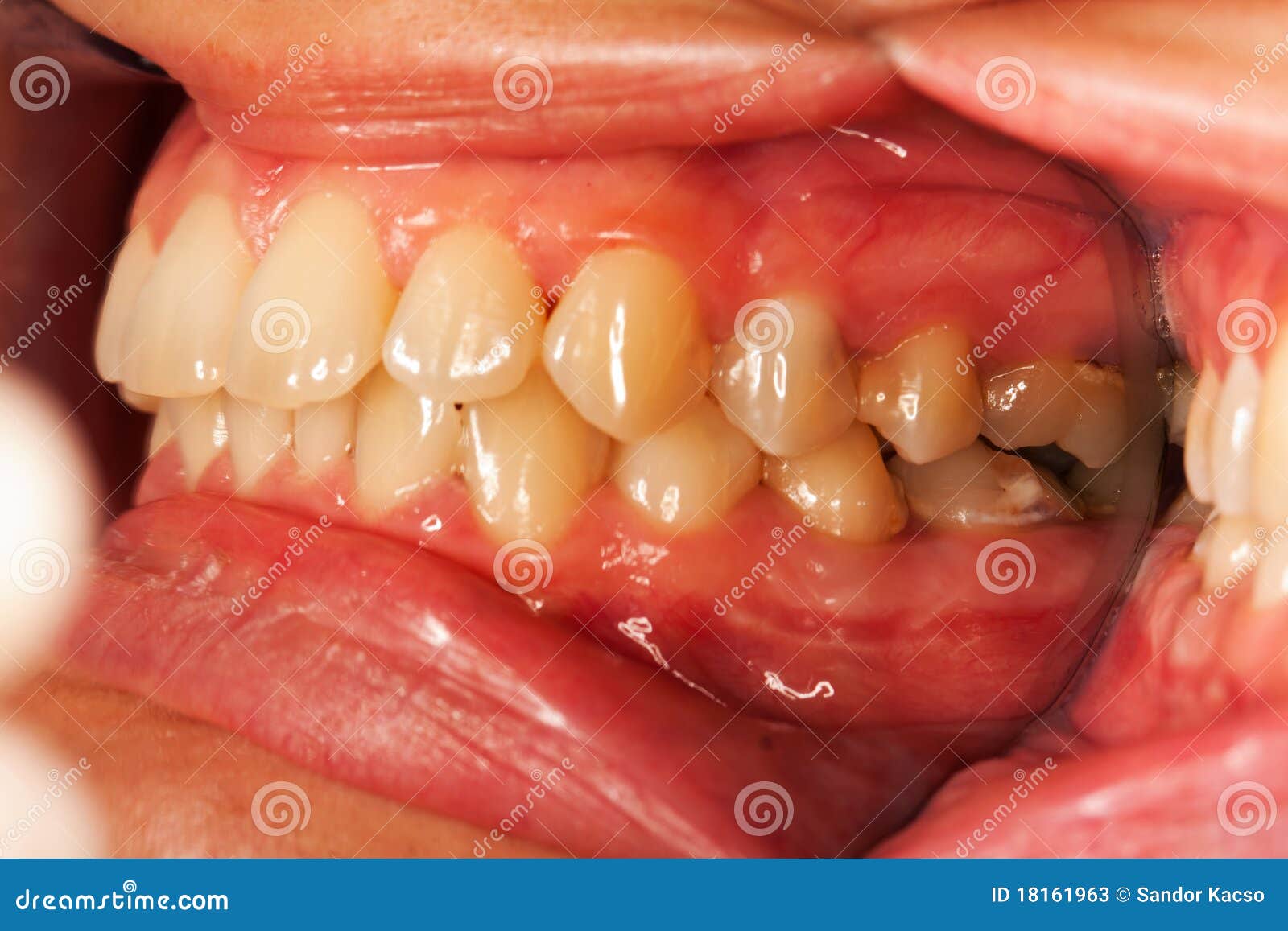 Human Teeth Stock Photos - Image: 18161963