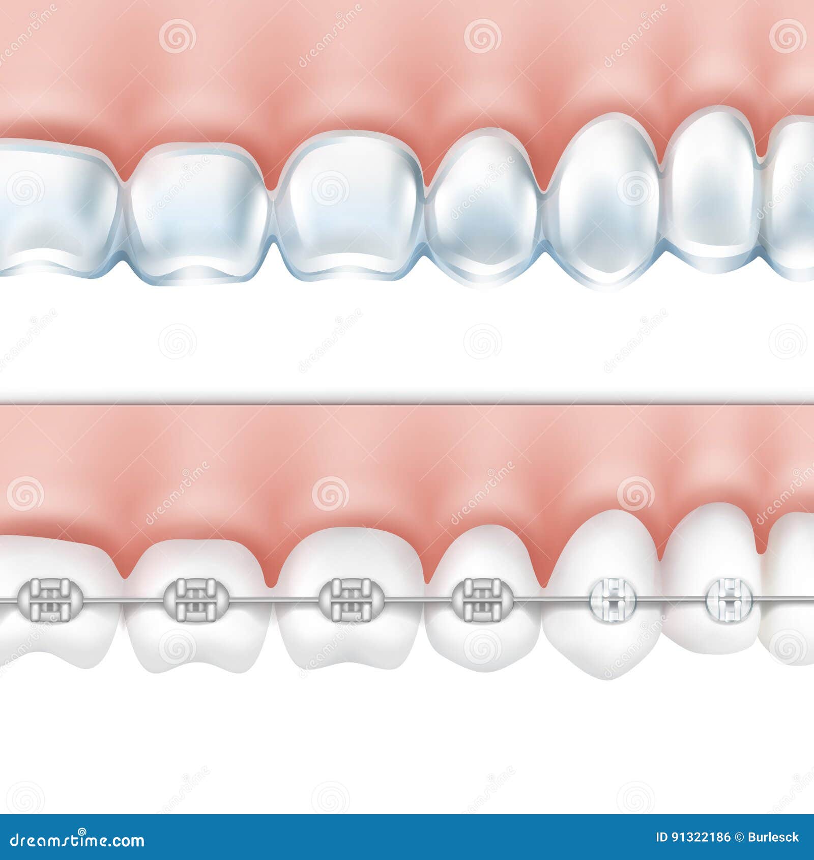 Prophylaxis Transparent Icon. Prophylaxis Symbol Design From Den ...