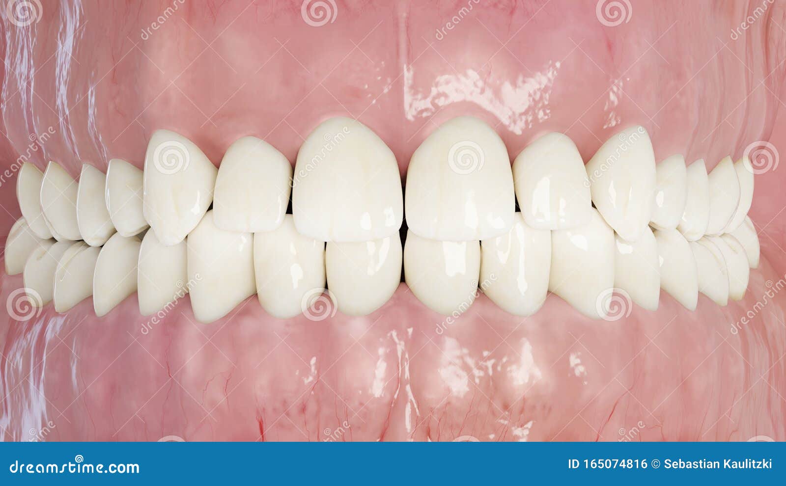 Human Teeth Infographic. Teeth Infographic Vector Illustration ...