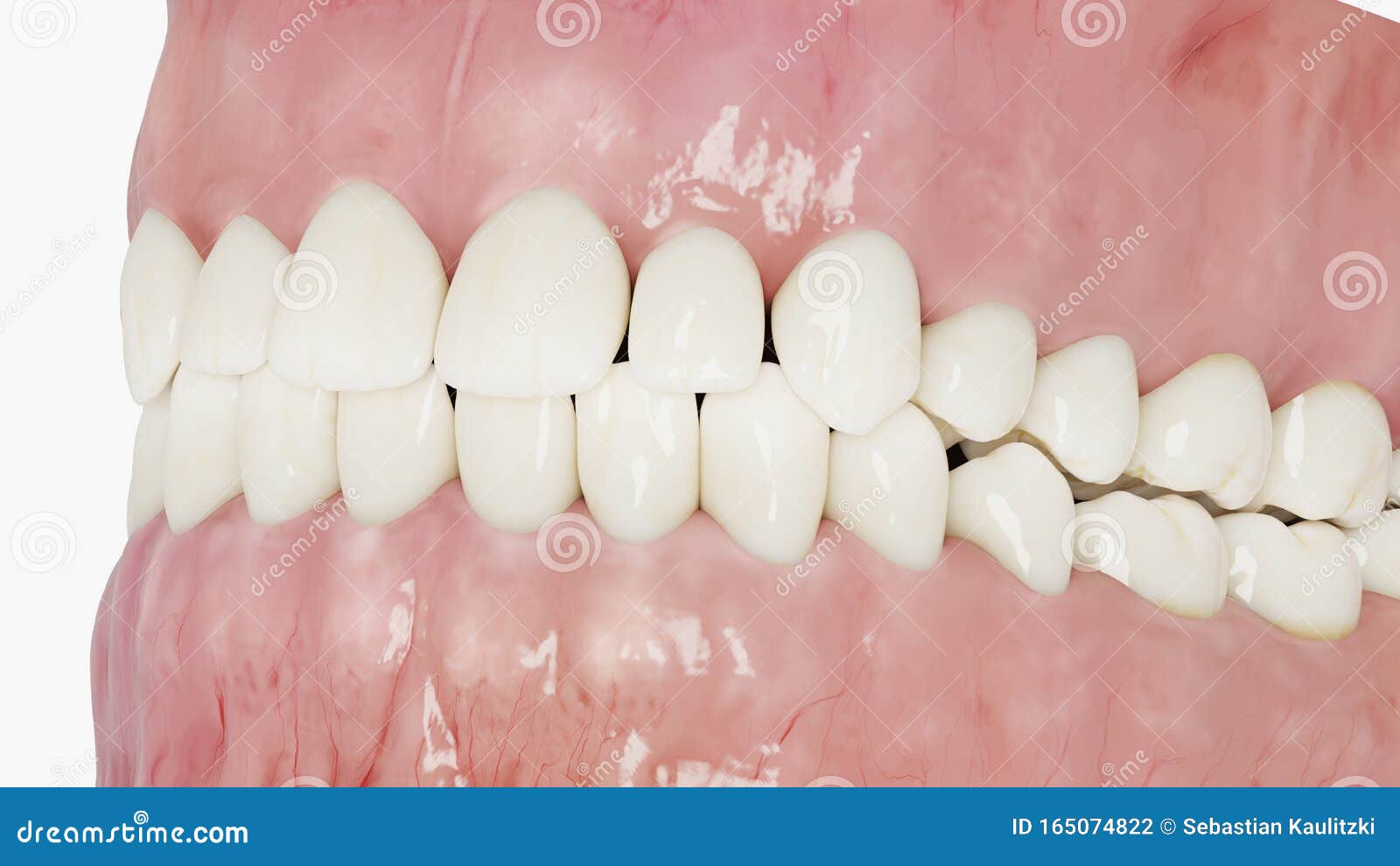 The human teeth stock illustration. Illustration of marode - 165074822