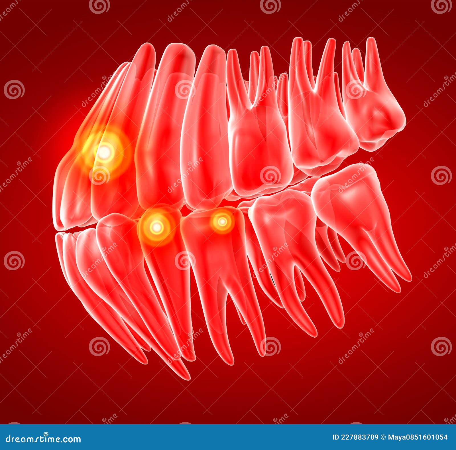 3D Rendering of Human Teeth Stock Illustration - Illustration of human ...