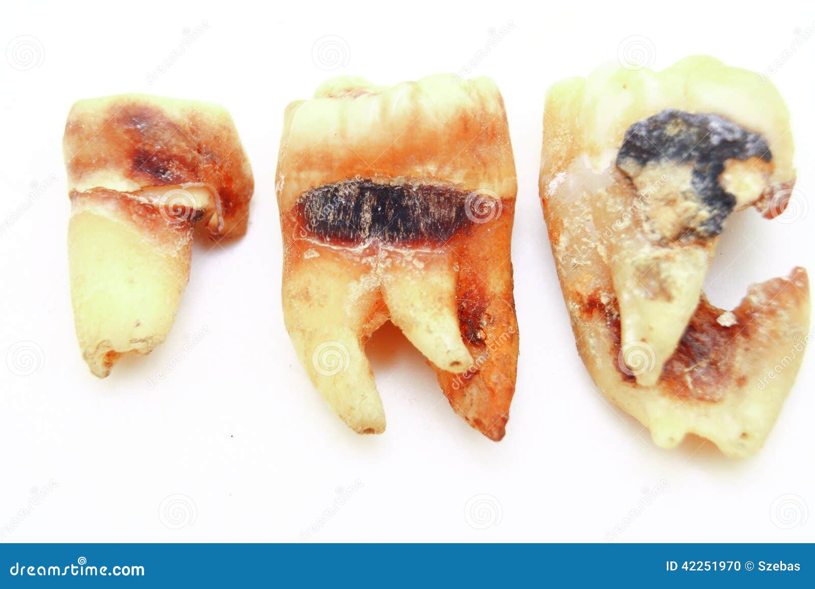 Human Teeth stock photo. Image of teeth, tooth, background - 42251970