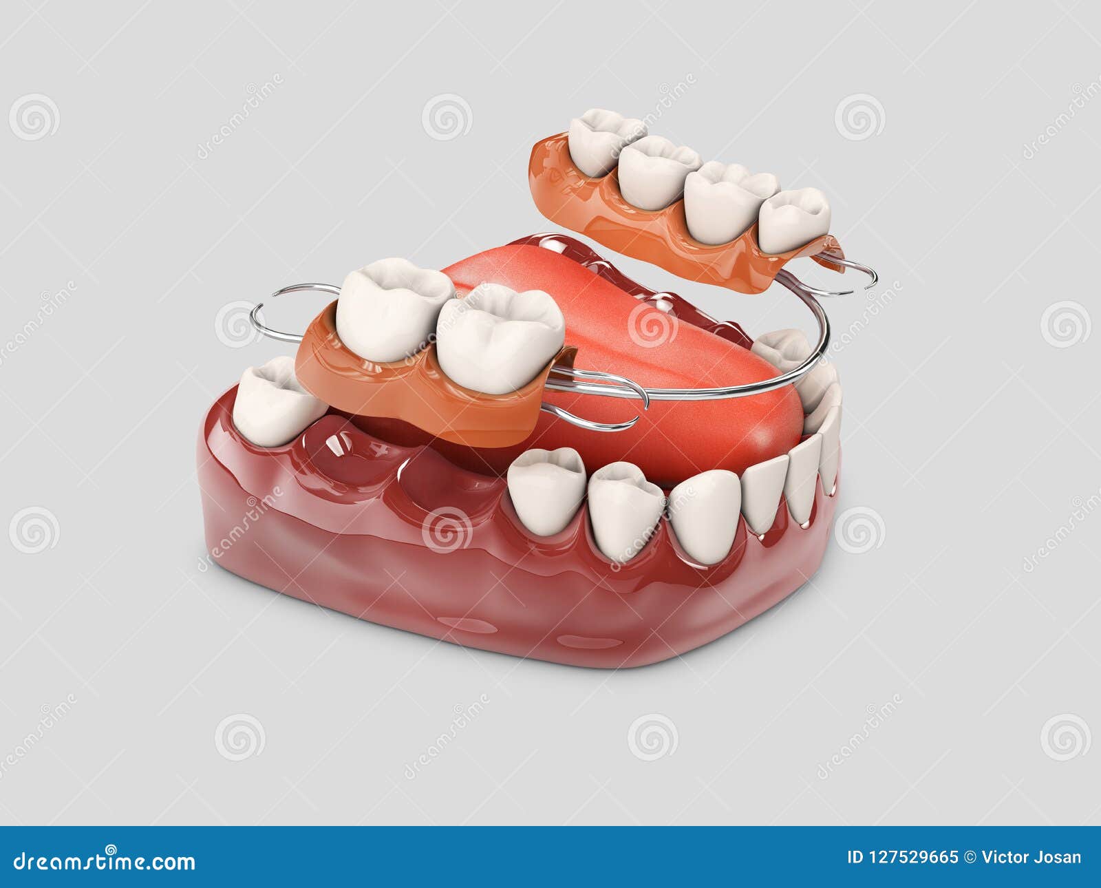 Human Denture 3D Image Stock Photography | CartoonDealer.com #61086002