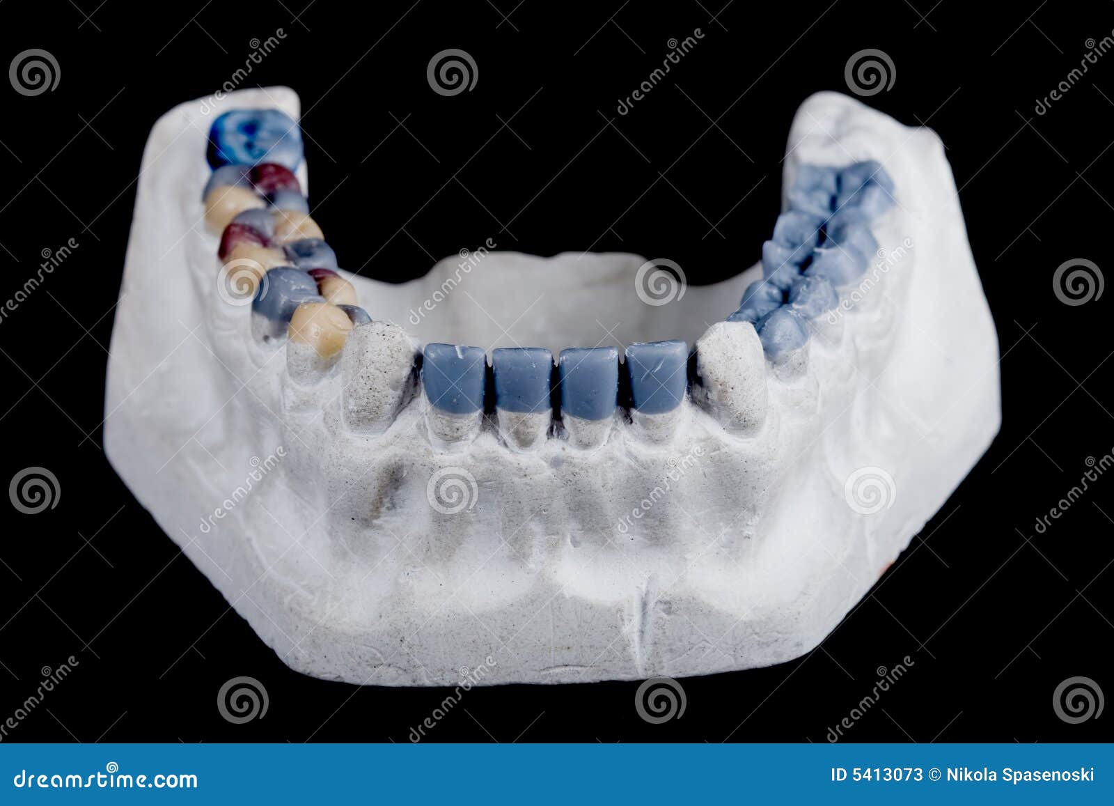 Human Teeth, Model Royalty-Free Stock Photography | CartoonDealer.com ...