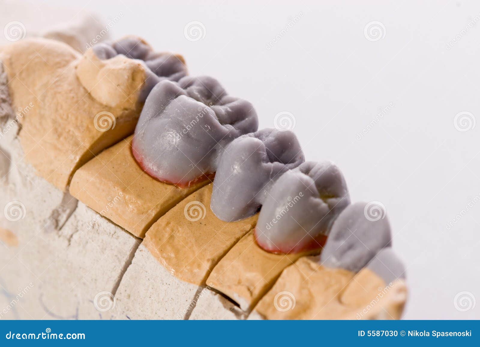Human Teeth, Model Royalty-Free Stock Image | CartoonDealer.com #5575036