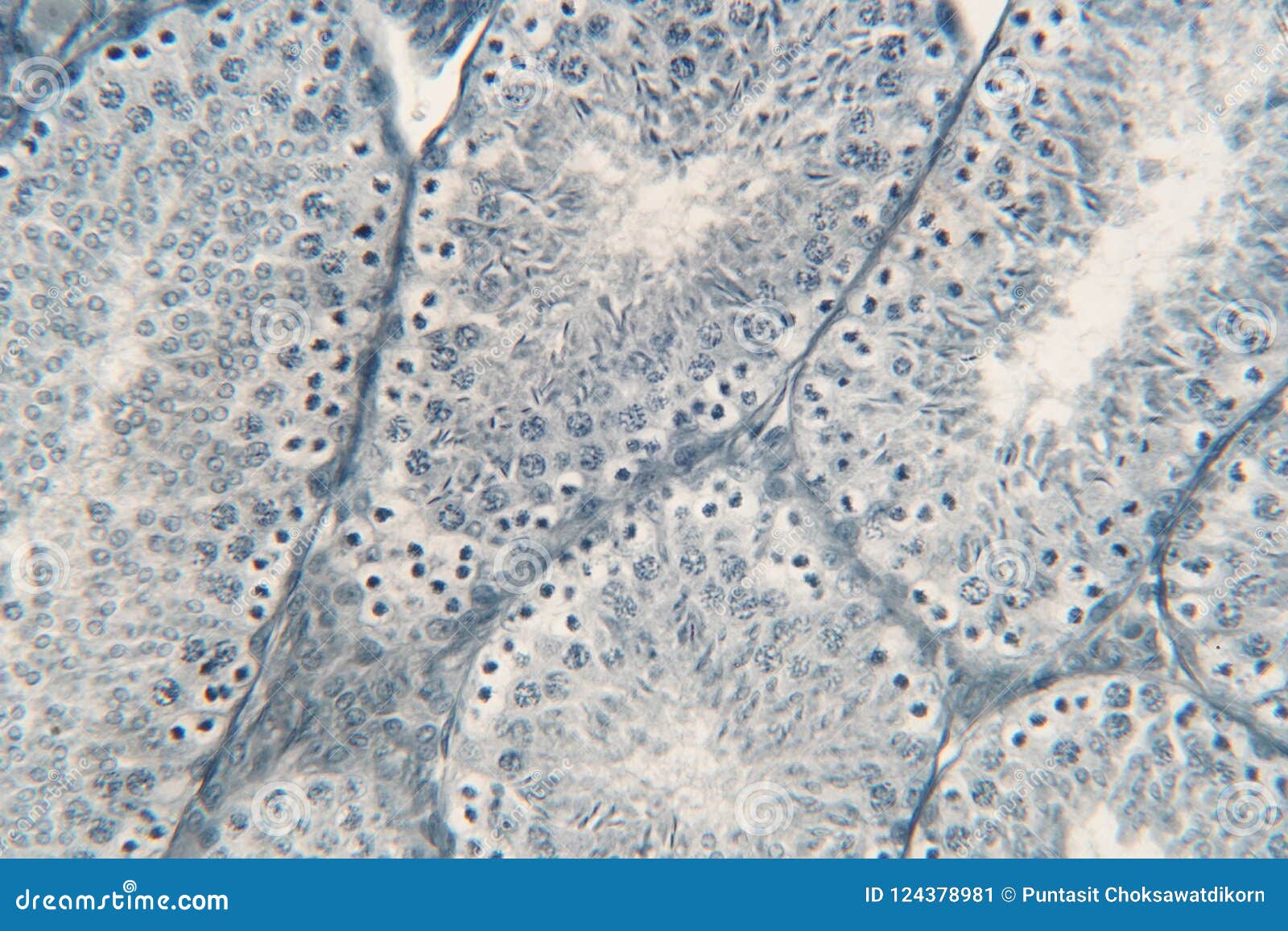 Human Testis Under Microscope View Stock Image Image Of Cell Anatomical 124378981