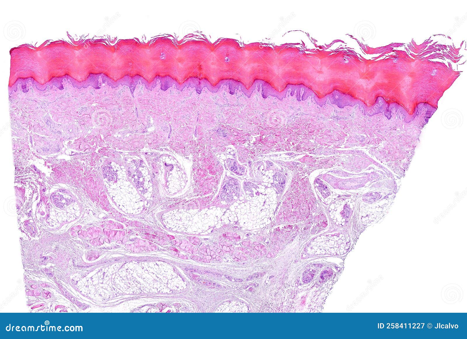 Human Thick Skin. Sole of the Foot Stock Image - Image of dermis, layer ...