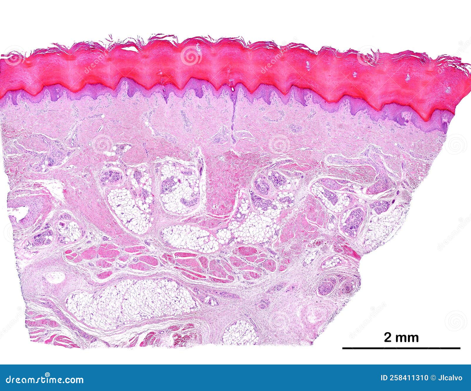 Human Thick Skin. Sole of the Foot Stock Photo - Image of microscope ...