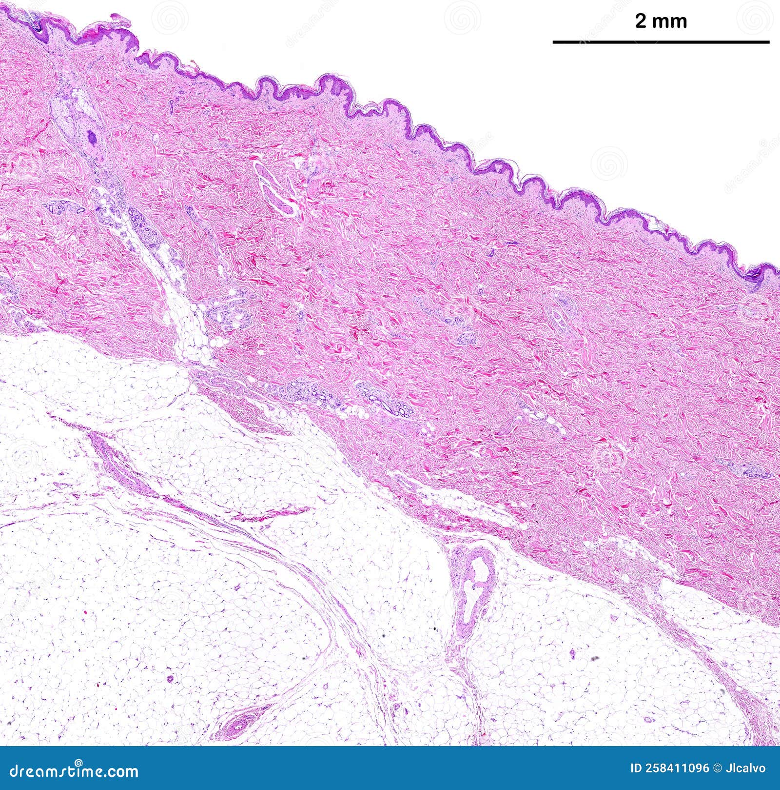 Thin Skin. Epidermis And Dermis Royalty-Free Stock Photo ... Thin Skin. Epidermis And Dermis Royalty-Free Stock Photo ...