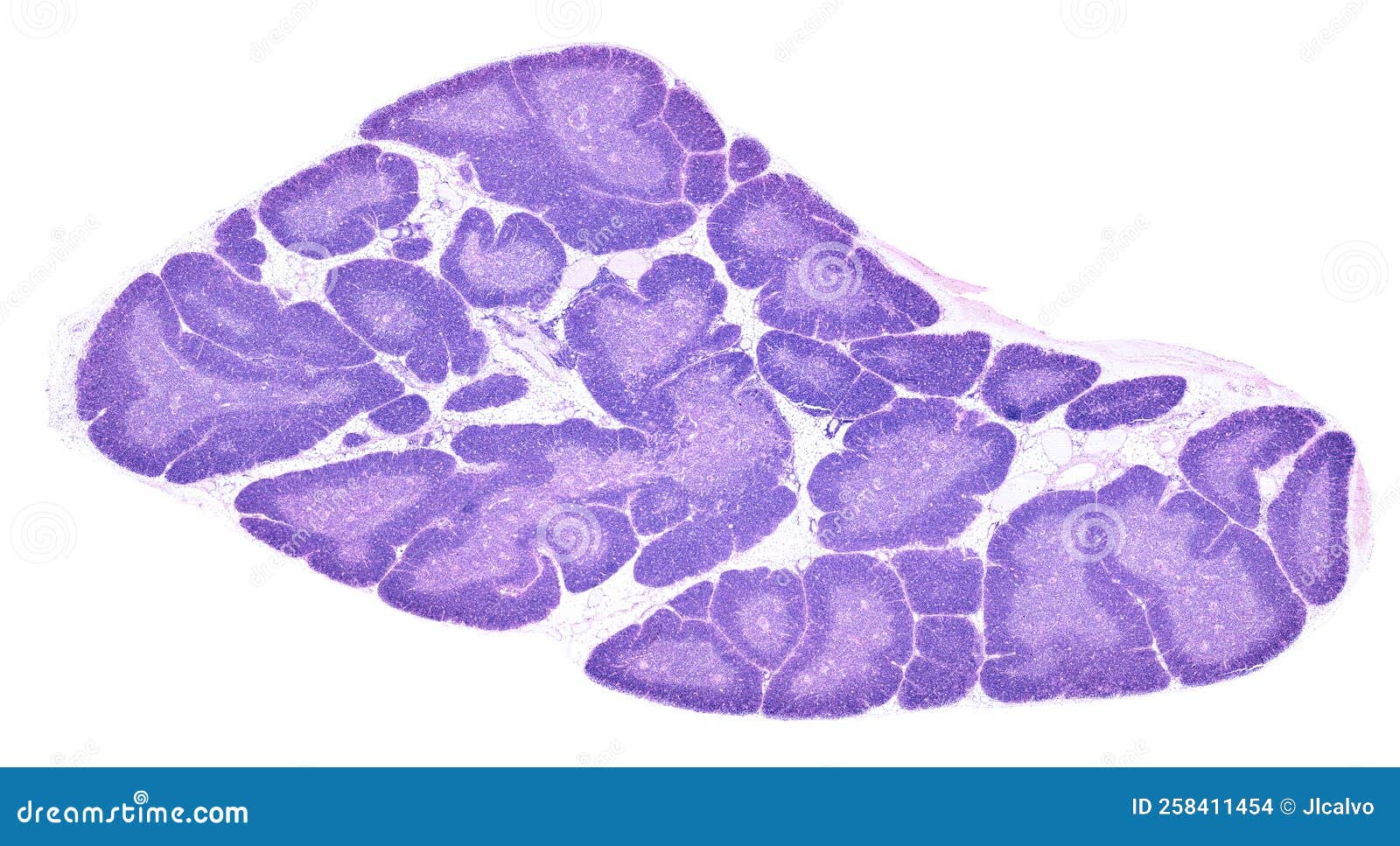 Human Thymus. Cortex and Medulla Stock Photo - Image of immune ...