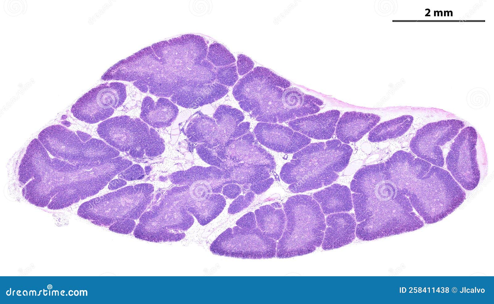 Human Thymus. Cortex and Medulla Stock Photo - Image of histological ...