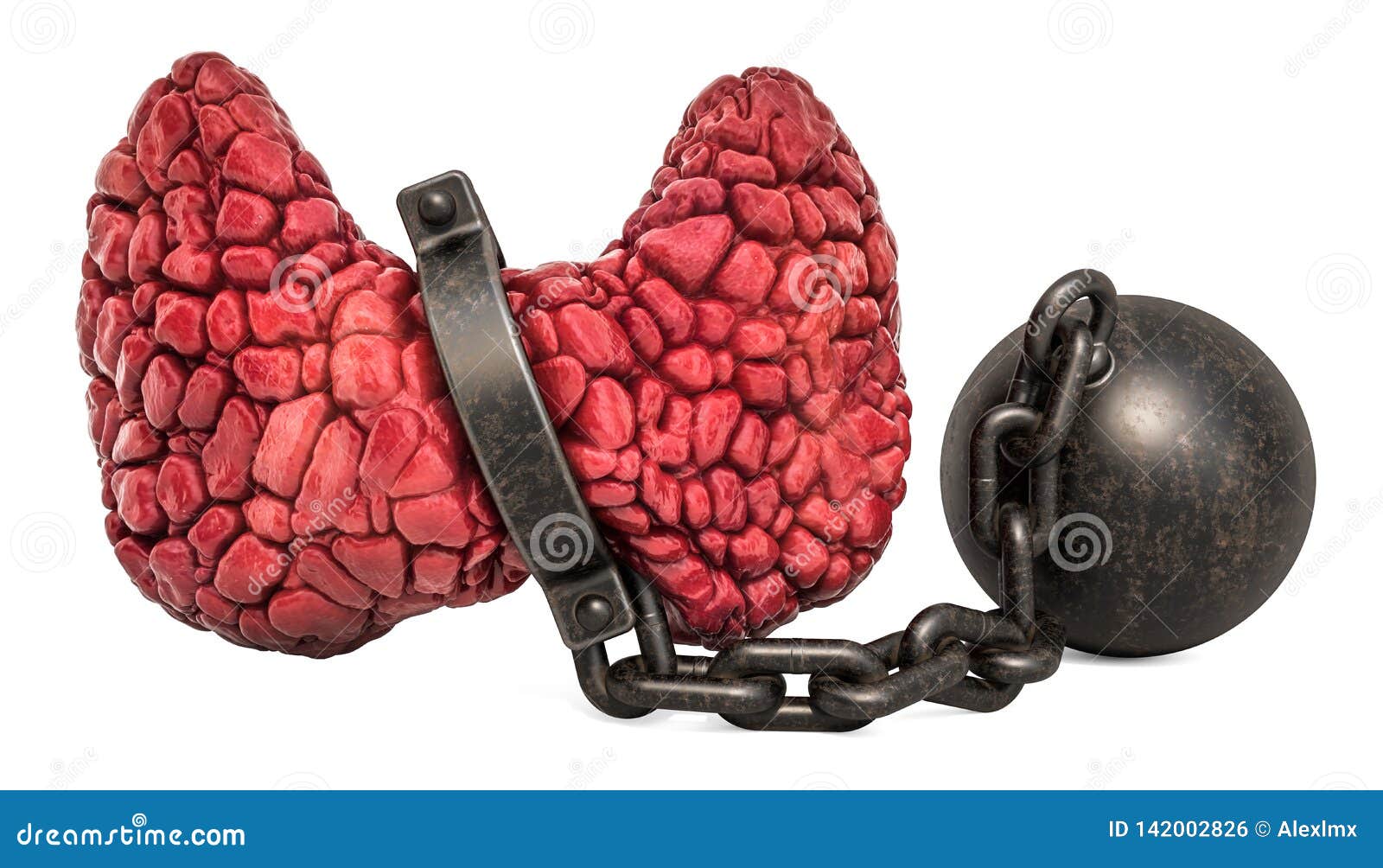 Human Thyroid with Shackle. Thyroid Disease Concept Stock Illustration ...