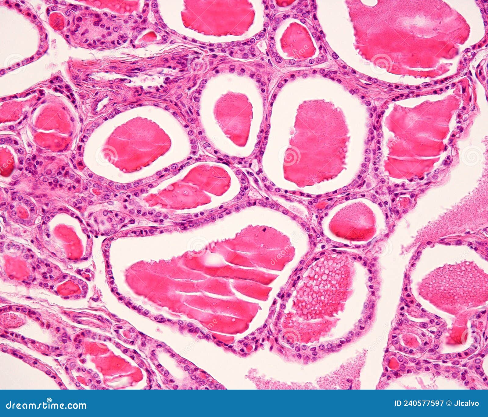 Human thyroid gland stock image. Image of medicine, body - 240577597