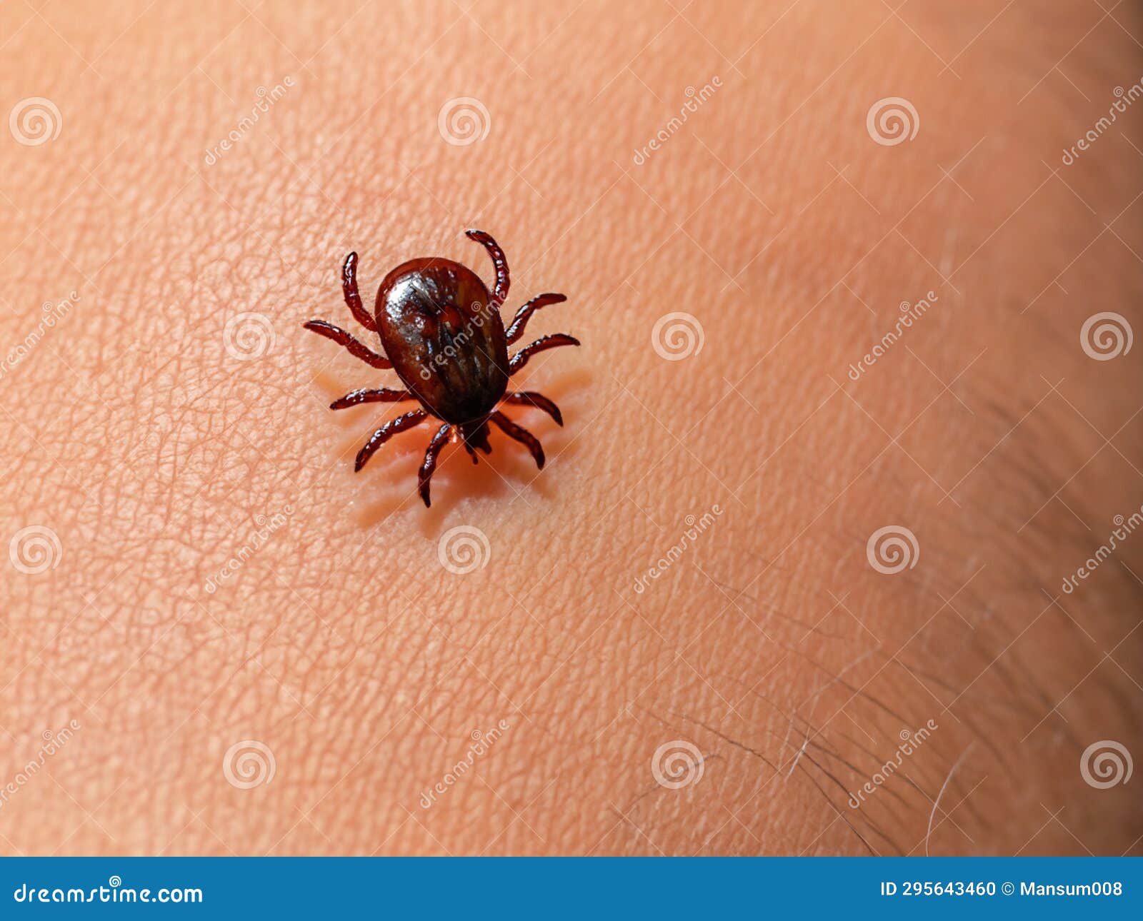 Human tick with blood skin stock illustration. Illustration of medicine ...
