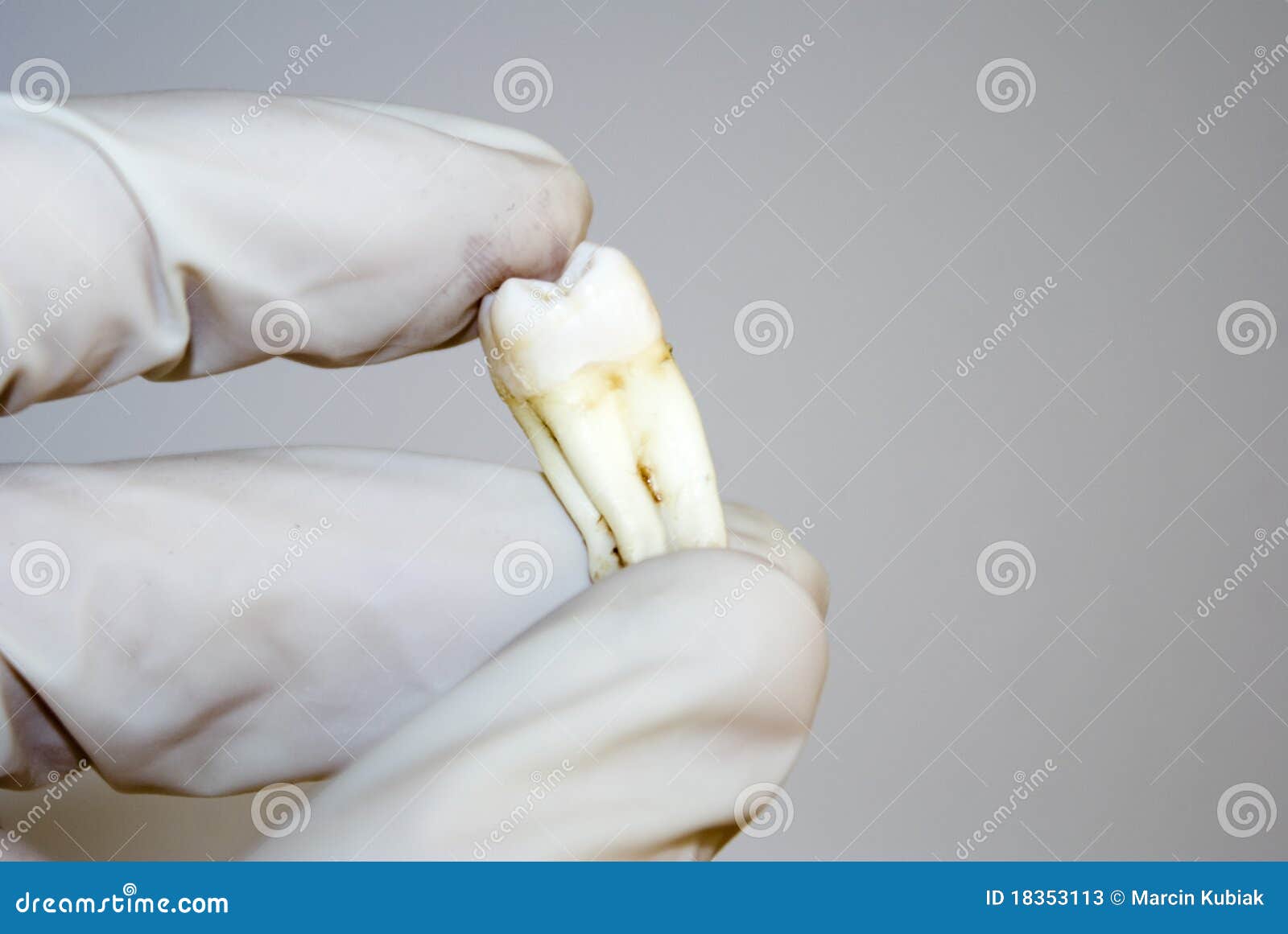 Human tooth stock image. Image of adult, contribute, accessory - 18353113
