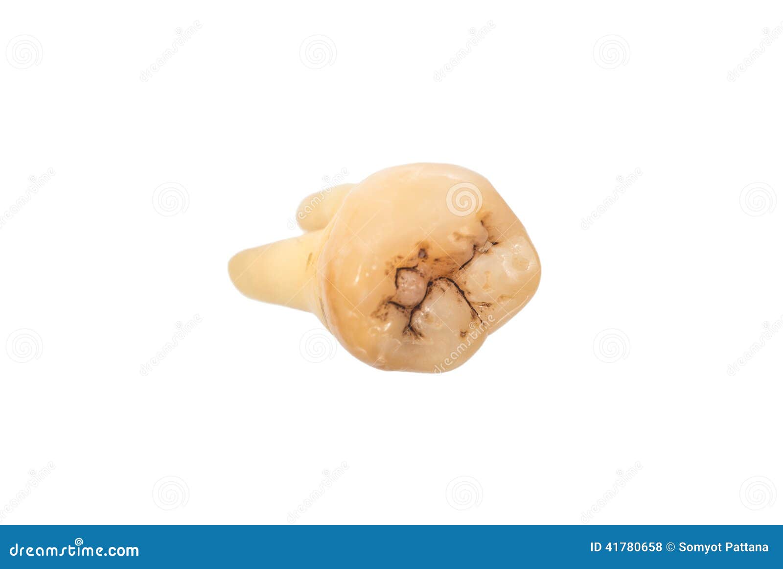 Human tooth stock photo. Image of macro, human, enamel - 41780658
