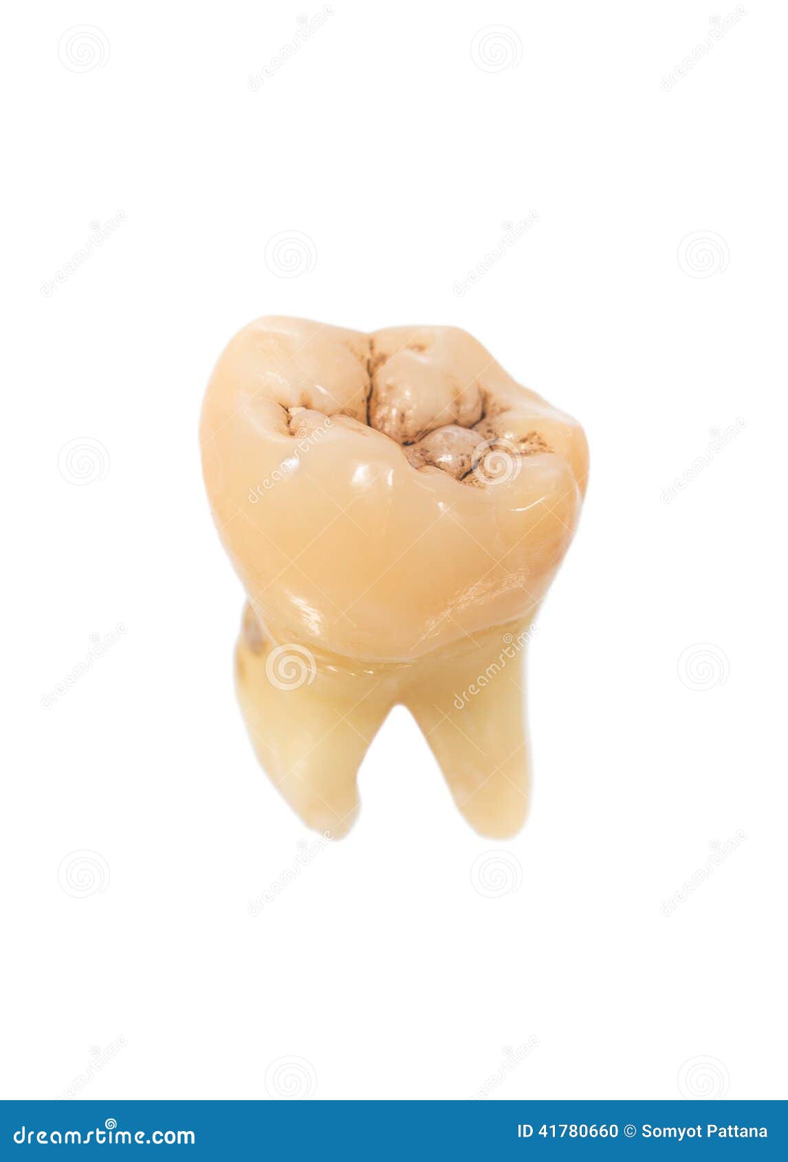 Human tooth stock photo. Image of mouth, health, human - 41780660