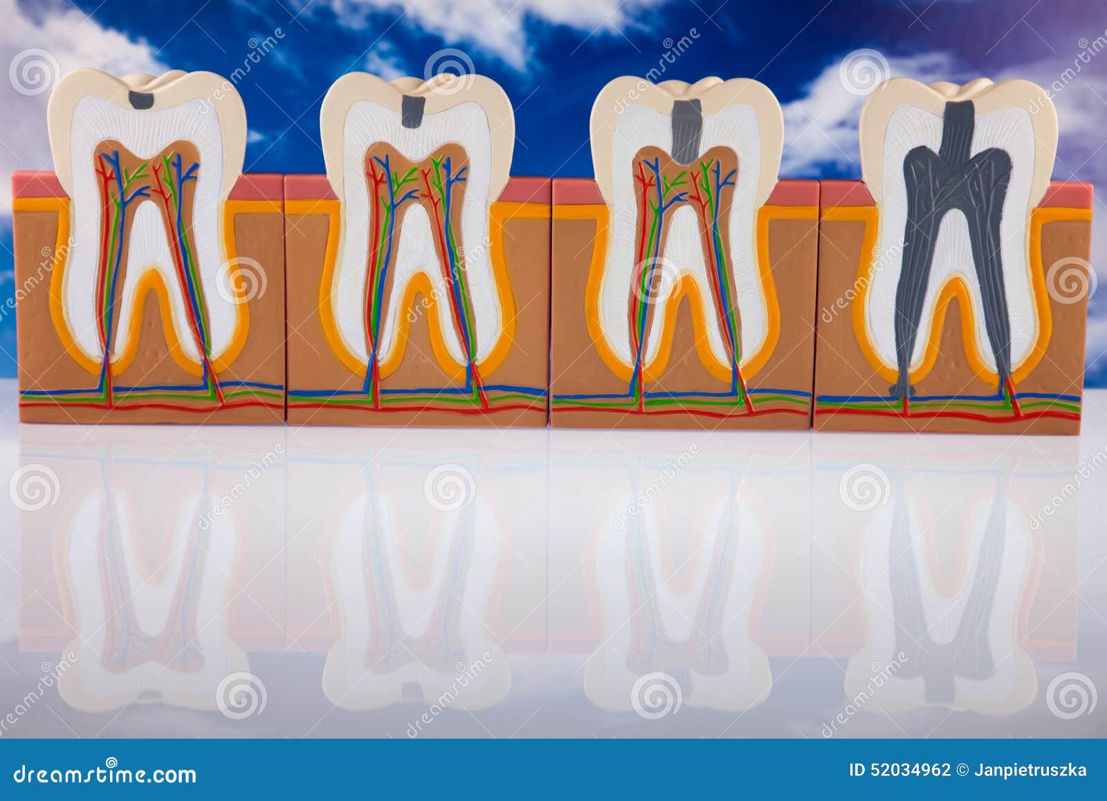 Human Tooth Structure, Bright Colorful Tone Concept Stock Photo - Image ...