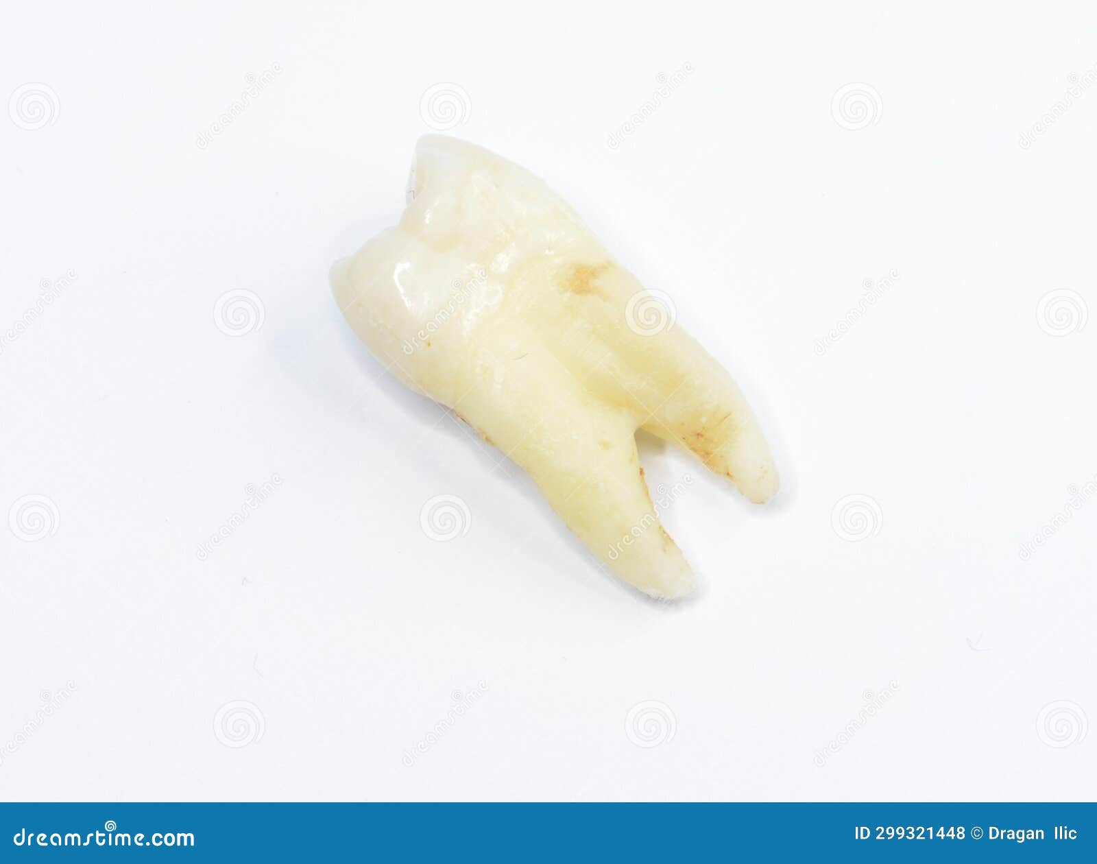 Human tooth with two roots stock photo. Image of calculus - 299321448