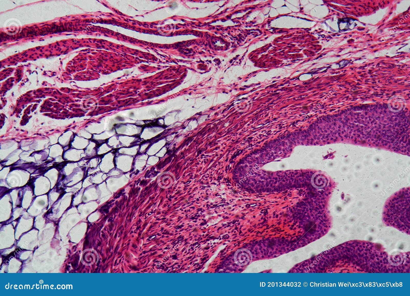 Transitional Epithelium Labeled