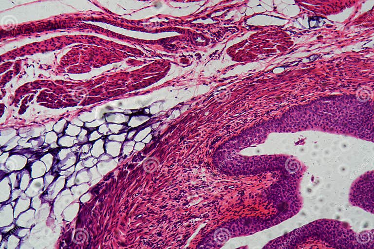 Human Transitional Epithelium Under the Microscope Stock Photo - Image ...